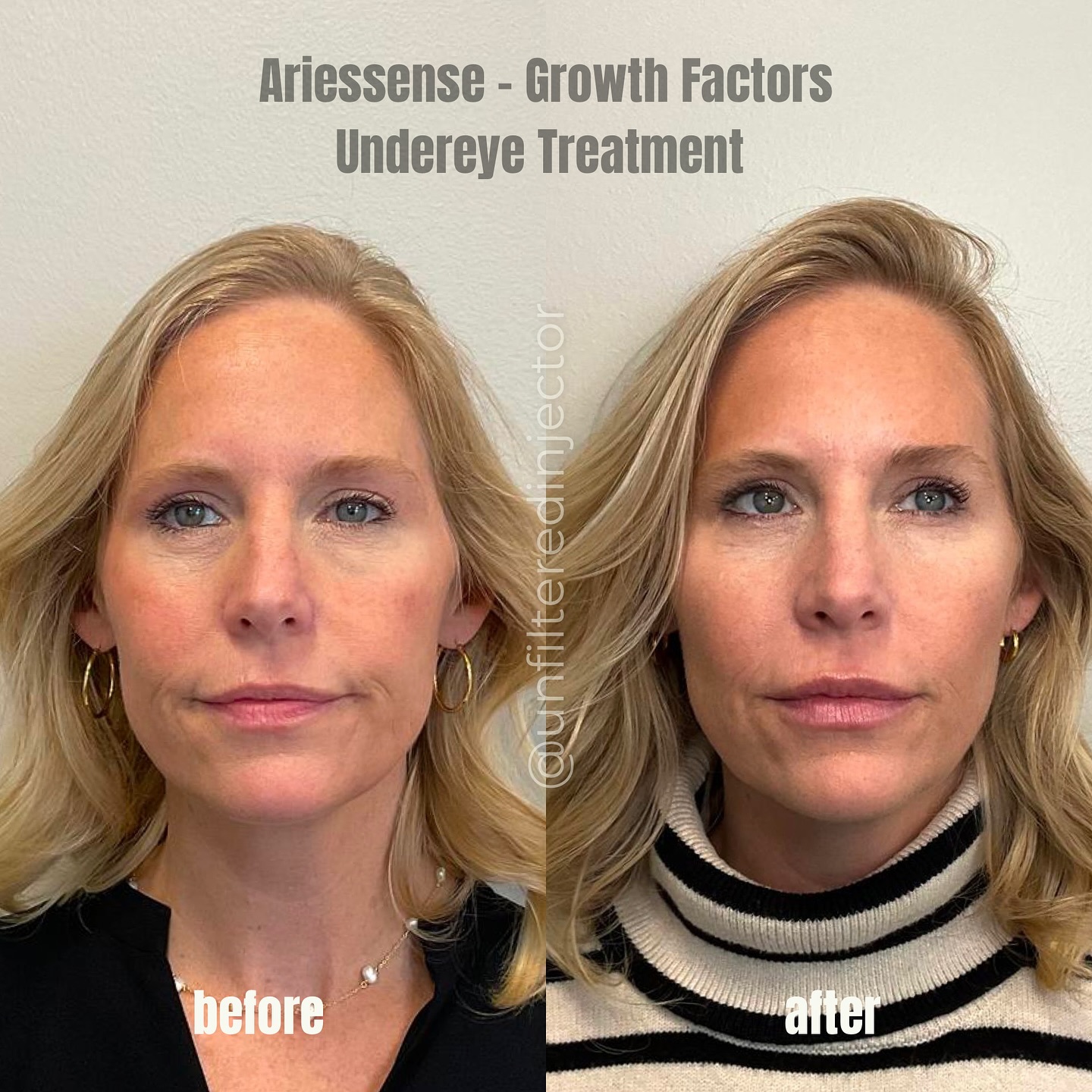 How to Discover Top Clinics for Laser Rejuvenation Results Near Tysons ...